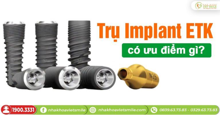 5 ưu điểm của trụ implant ETK Pháp