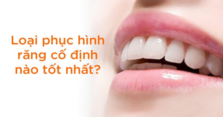 Phục hình răng cố định có những loại nào?